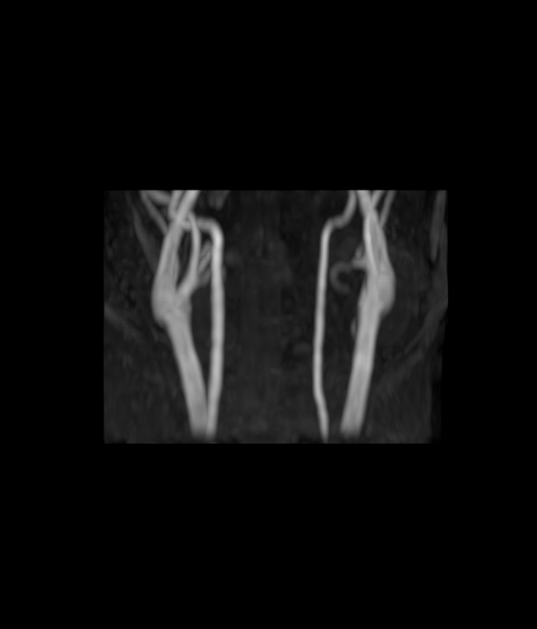 【脳ドック結果の疑問を解消】MRI画像の種類（T1, T2, FLAIR他）と見方・意味を徹底解説 | 東京都目黒・品川の脳神経外科、内科 ...